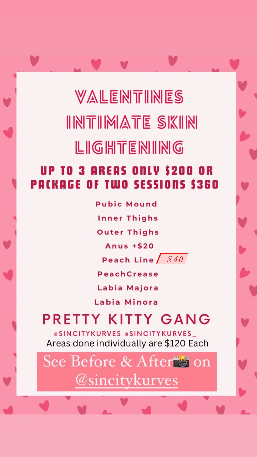 Body sculpting – Sin City Kurves